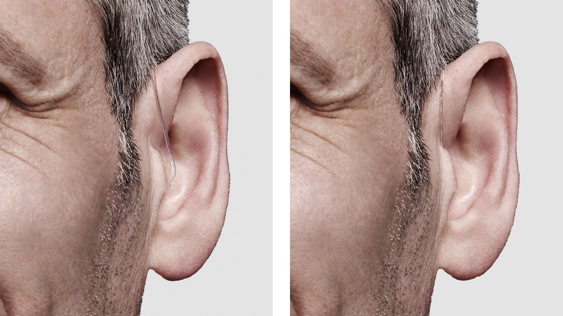 Signia Earwear 3.0 - Click Sleeves, Earmolds and WaxGuards